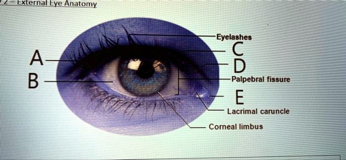 SOLVED: Names of A-E Eyelashes Palpebral fissure E Lacrimal caruncle ...