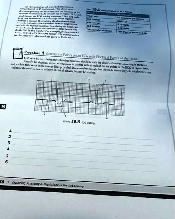 procedure correlating points on an ecgwith electrical evnts of the heart identify the electrical ...