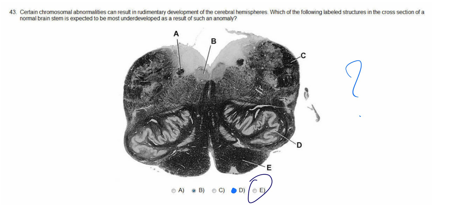 43 certain chromosomal abnormalities can result in rudimentary ...