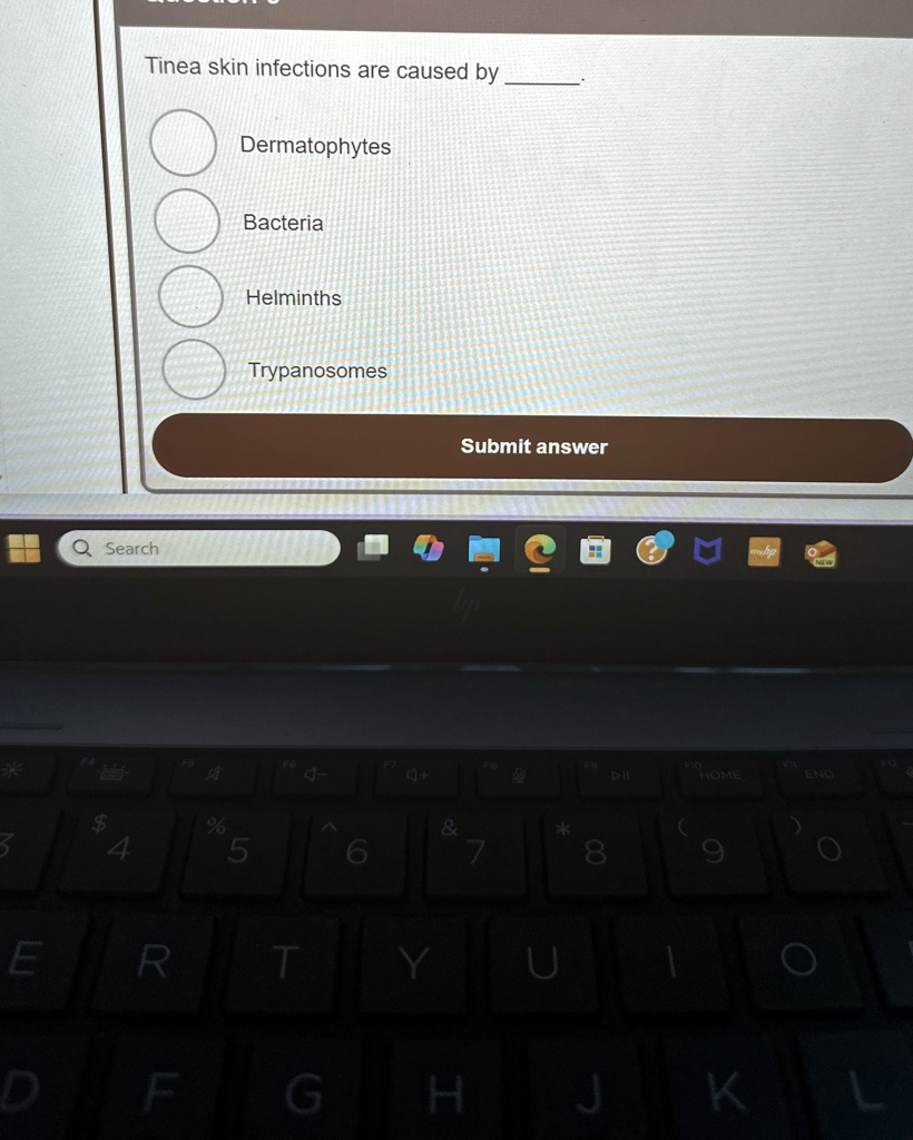 Tinea skin infections are caused by Dermatophytes Bacteria Helminths ...