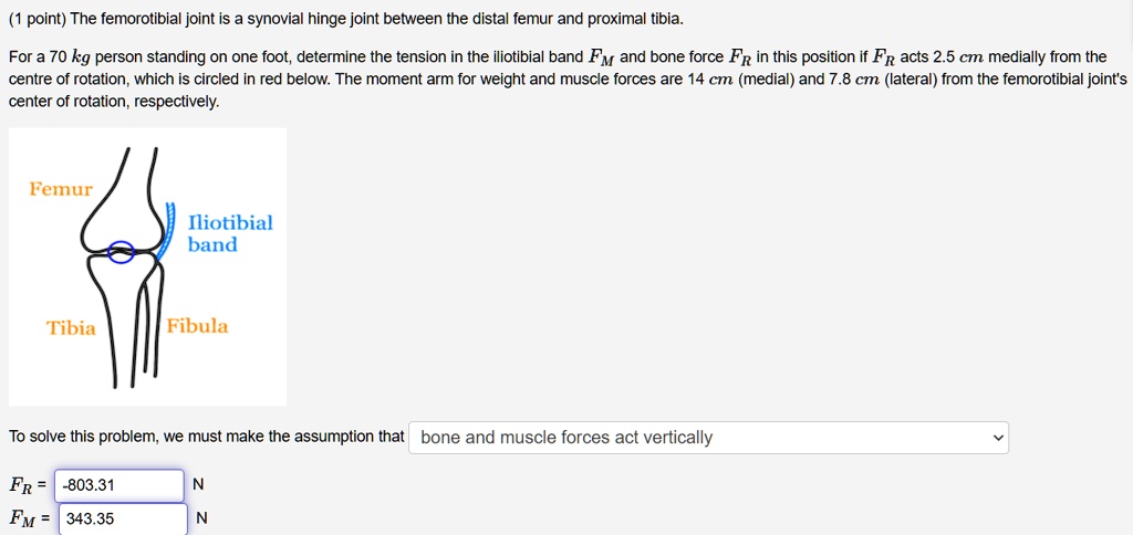 SOLVED: The femorotibial joint is a synovial hinge joint between the ...