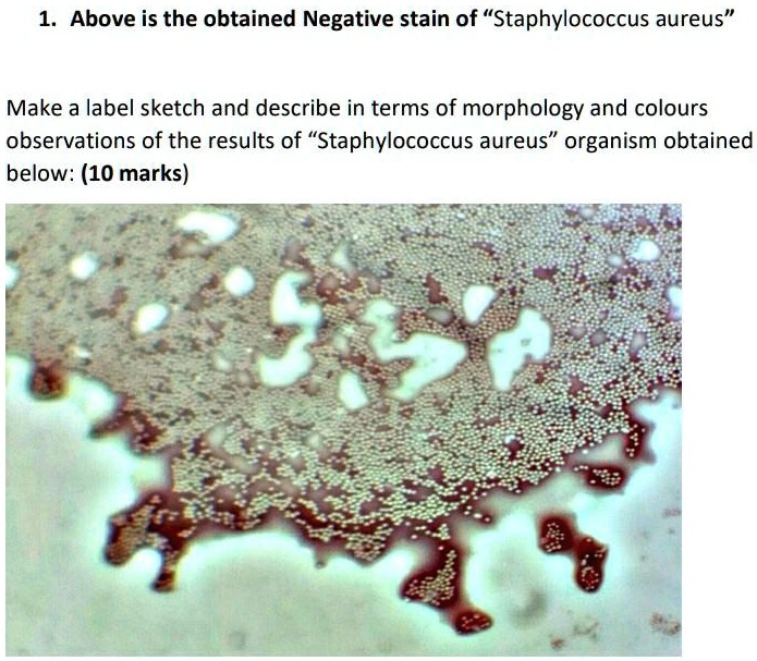 above is the obtained negative stain of staphylococcus aureus make a ...