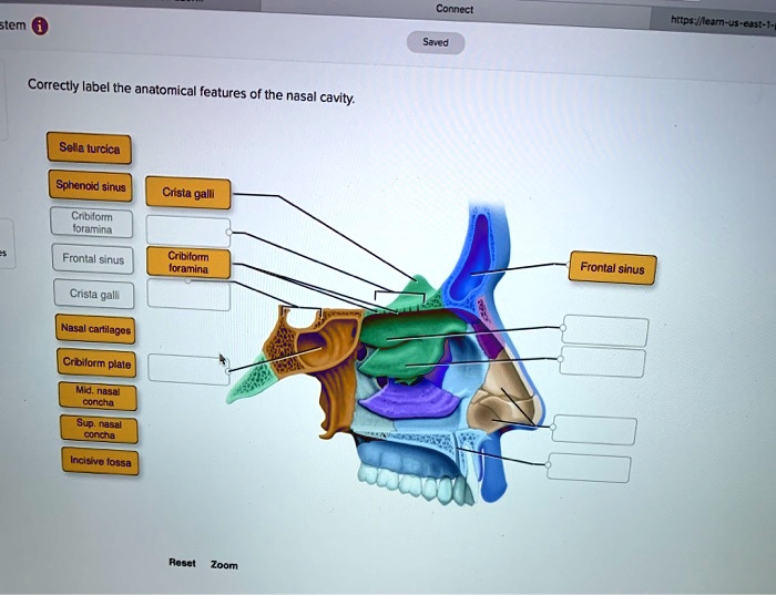 stem i Correctly label the anatomical features of the nasal cavity ...