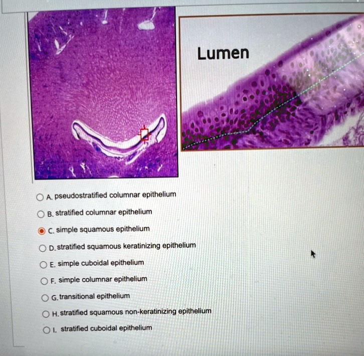 Lumen A. pseudostratified columnar epithelium B. stratified columnar ...