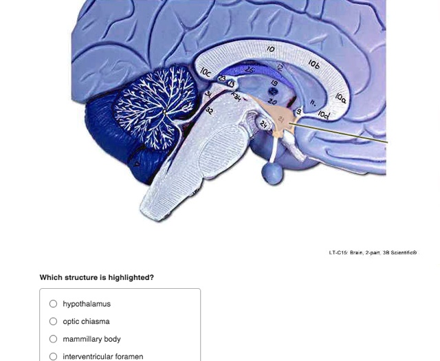 SOLVED: T LT-C15: Brain2-part, 3B Scientific Which structure is ...