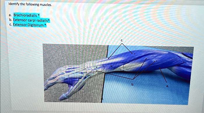 SOLVED: Are my answers correct? A, B, and C? Identify the following ...