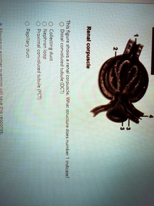 SOLVED: Proximal convoluted tubule (PCT), Nephron loop, Collecting duct ...