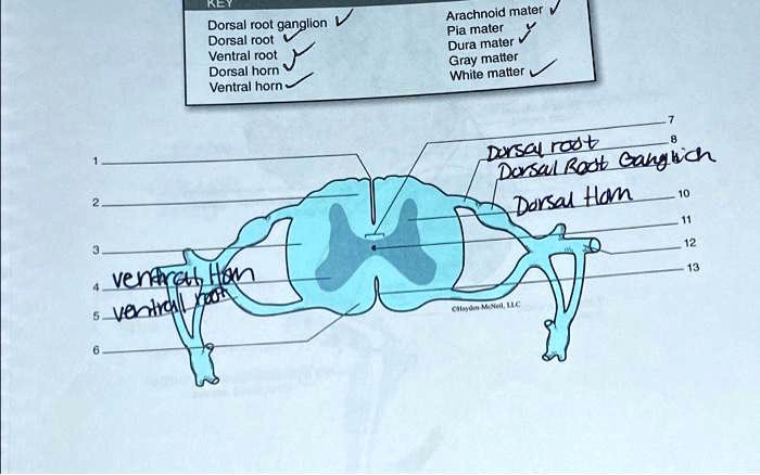 1 2 KEY Dorsal root ganglion Arachnoid mater Dorsal root Pia mater ...