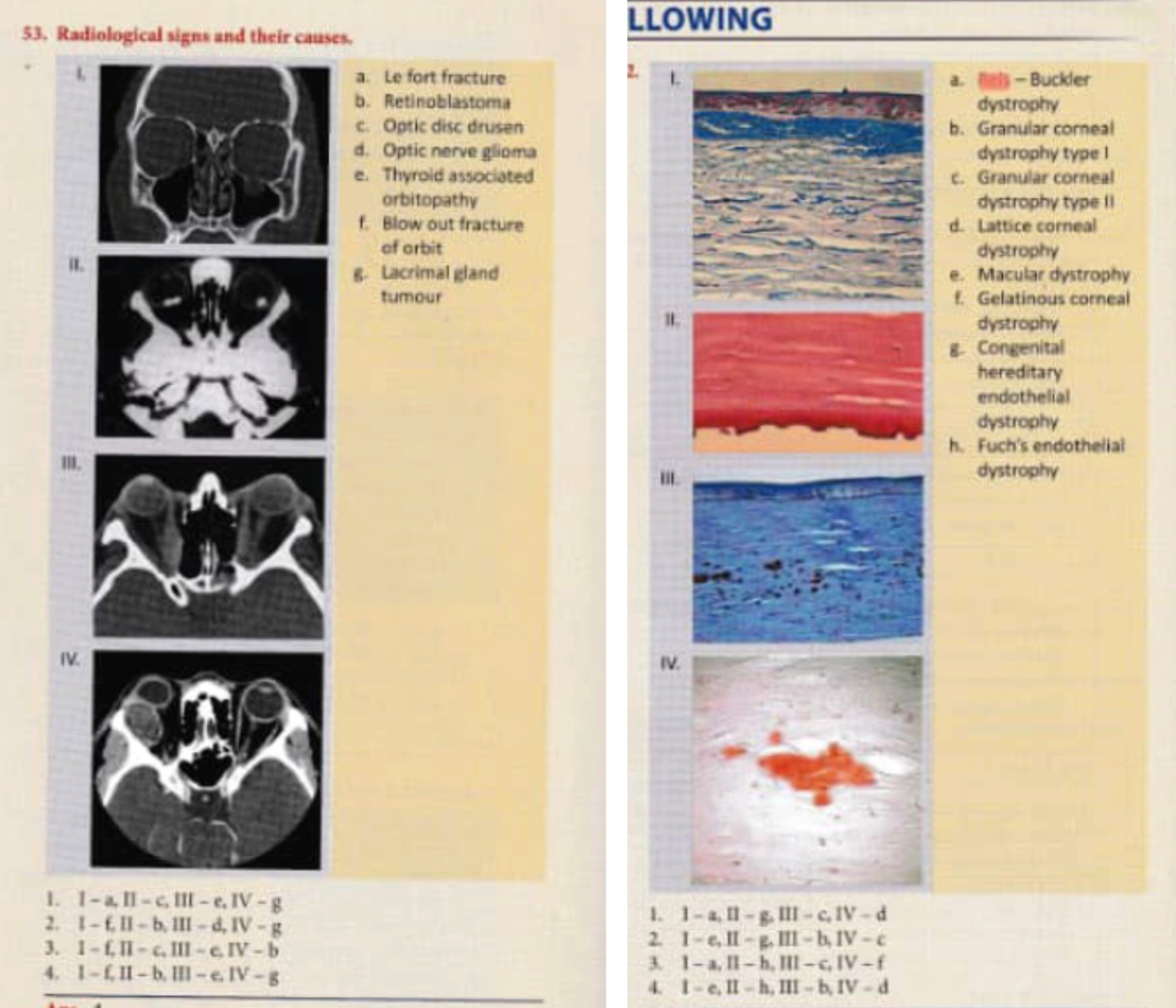 SOLVED: 53. Radiological signs and their causes. it. III. IV. 1. I-a ...
