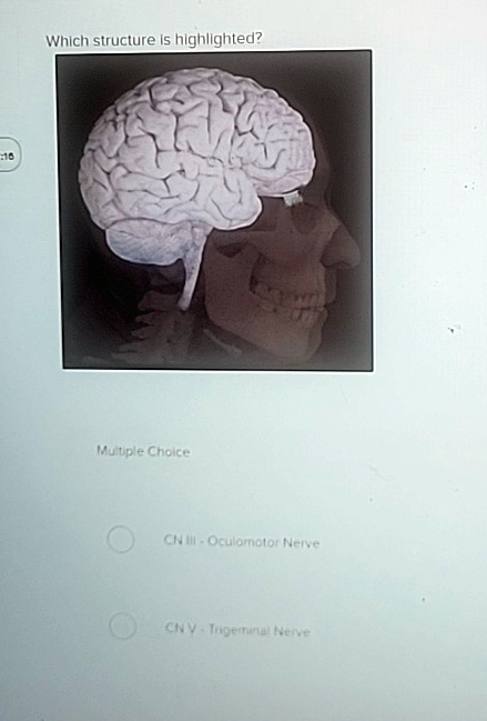 Which structure is highlighted? Multiple Choice ☐ CN III - Oculomotor ...