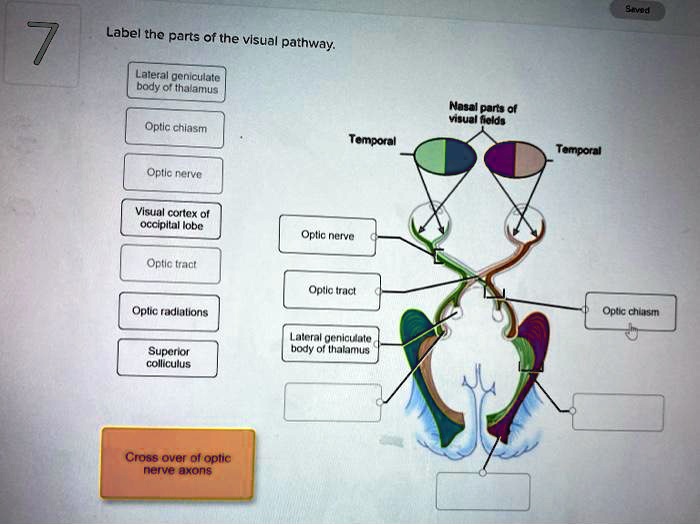 Solved 7 Label The Parts Of The Visual Pathway Lateral Geniculate Body