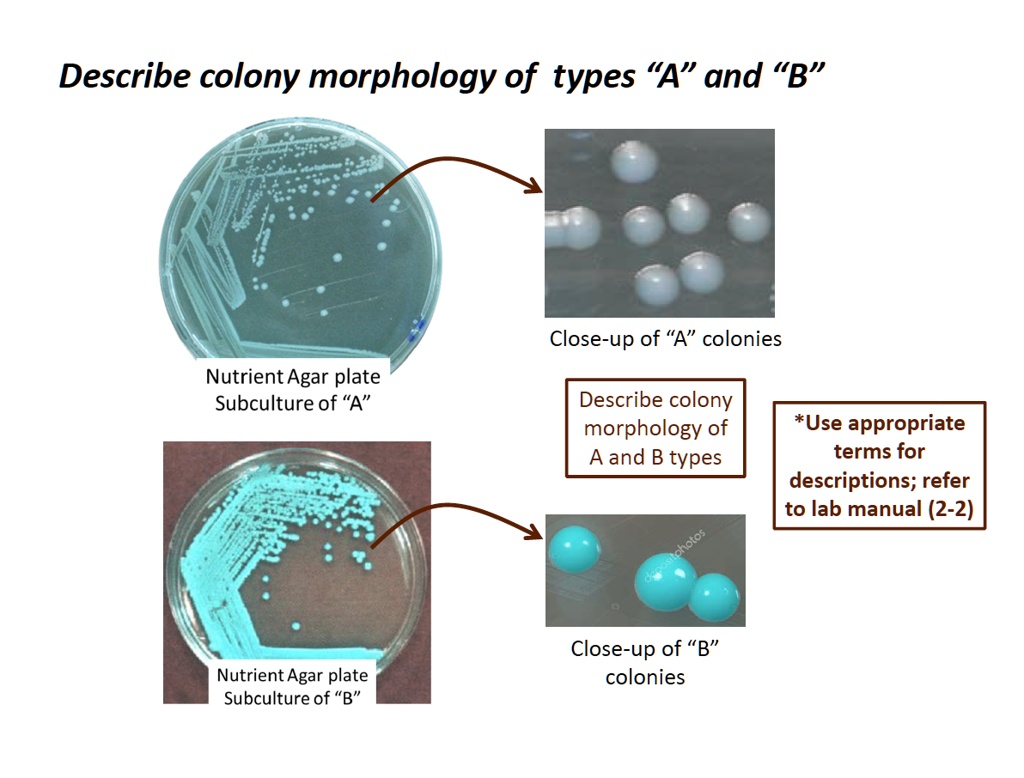 describe colony morphology of types a and b close up of a colonies ...