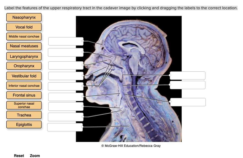 label the features of the upper respiratory tract in the cadaver image ...