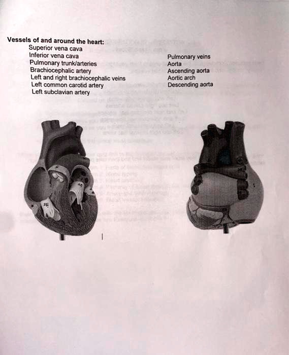 SOLVED: Please help with the labels, thank you! Vessels of and around the heart: Superior vena ...