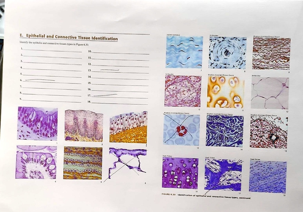 SOLVED: Texts: E. Epithelial and Connective Tissue Identification in ...