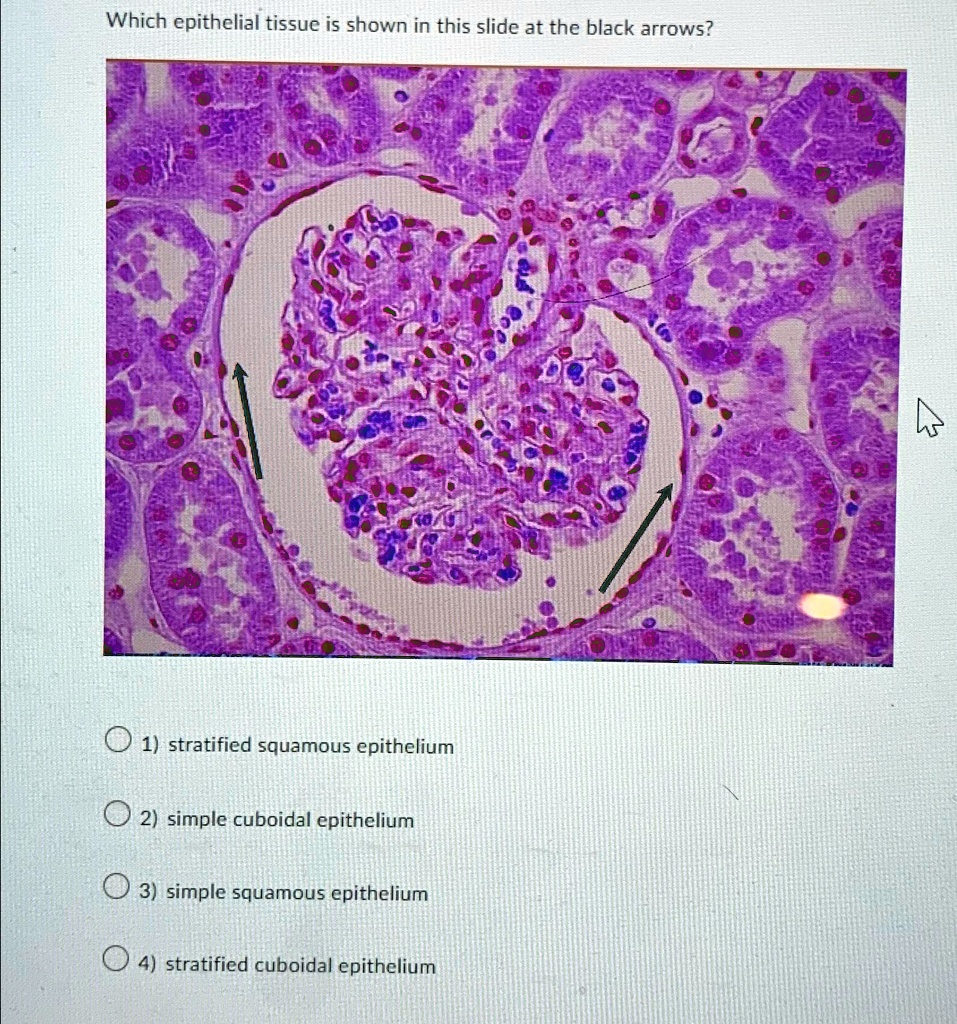 Which epithelial tissue is shown in this slide at the black arrows? 1 ...
