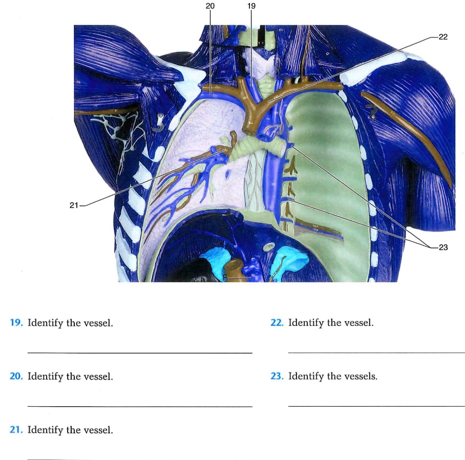 SOLVED: 20 19 22 21 23 19.Identify the vessel 22. Identify the vessel. 20. Identify the vessel ...