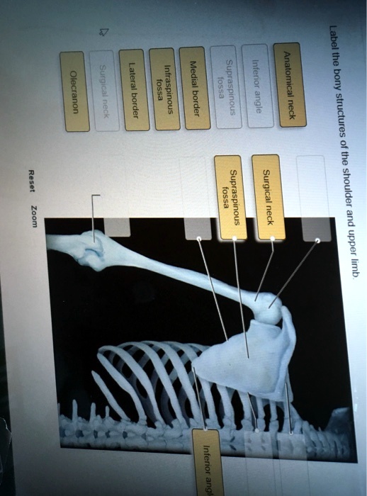 Label the bony structures of the shoulder and upper limb. Anatomical ...