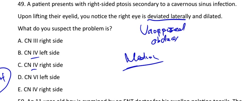 49 a patient presents with right sided ptosis secondary to a cavernous ...