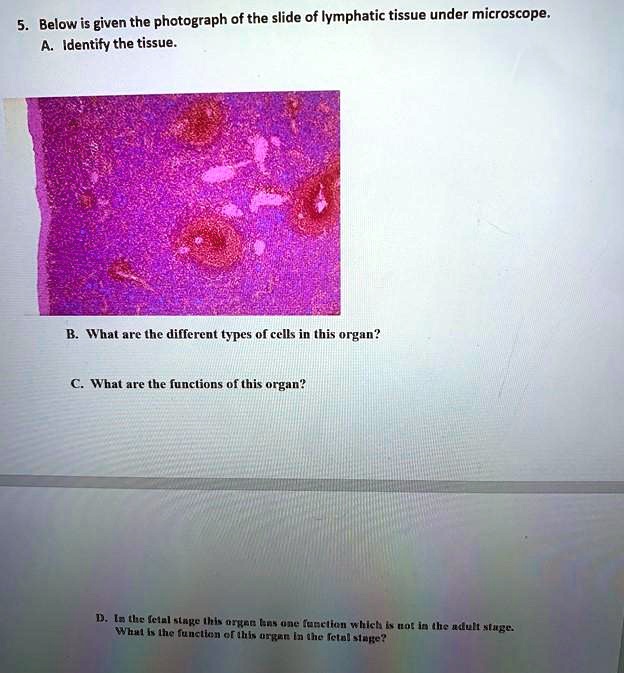 5. Below is given the photograph of the slide of lymphatic tissue under ...