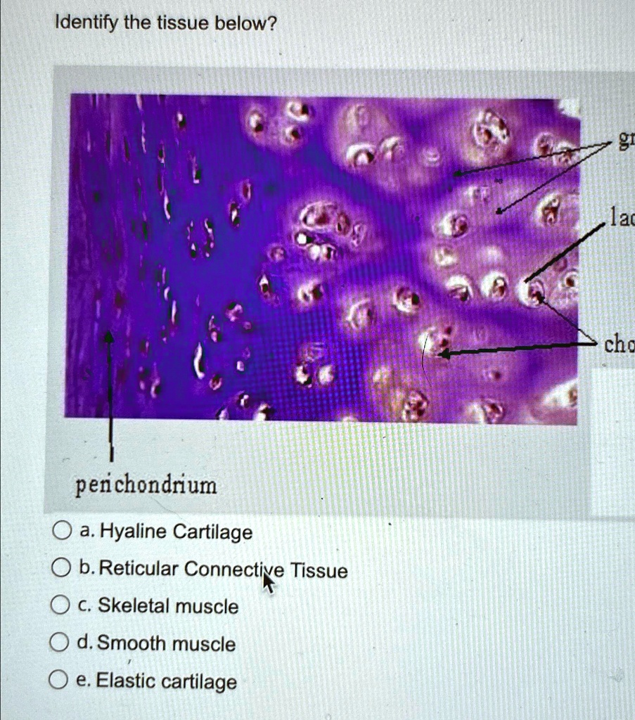 Identify the tissue below? perichondrium a. Hyaline Cartilage b ...