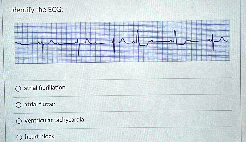 SOLVED: Identify the ECG: Atrial fibrillation Atrial flutter ...