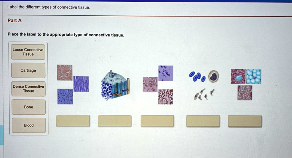label the different types of connective tissue part a place the label ...