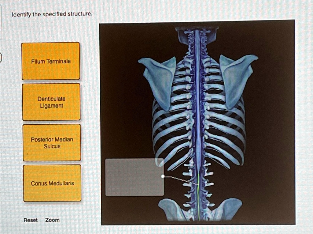 identify the specified structure identify the specified structure filum ...
