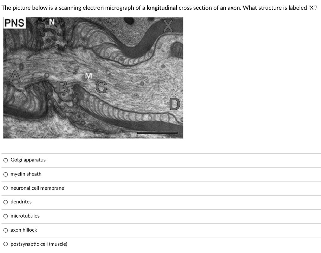 SOLVED: The picture below is a scanning electron micrograph of a ...