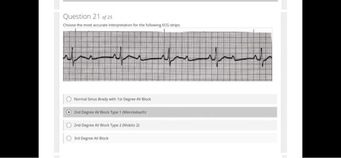 SOLVED: ecg Question 21ofs Normal Sinus Brady with st Degree AV Block ...