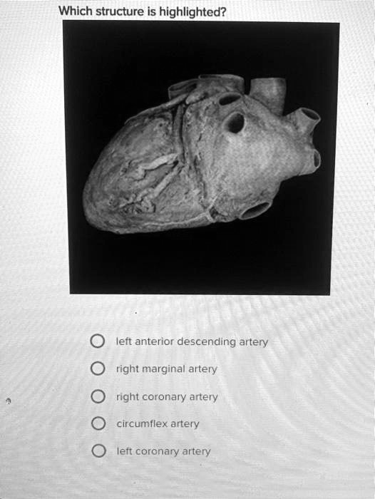 Solved Which Structure Is Highlighted Left Anterior Descending Artery