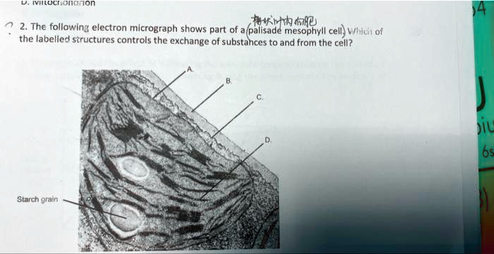 D. IVIILOCIonarion ?????? 2. The following electron micrograph shows part of a (palisade ...