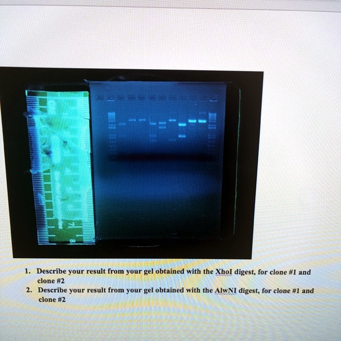 SOLVED: Describe your results from your gel obtained with the XhoI ...