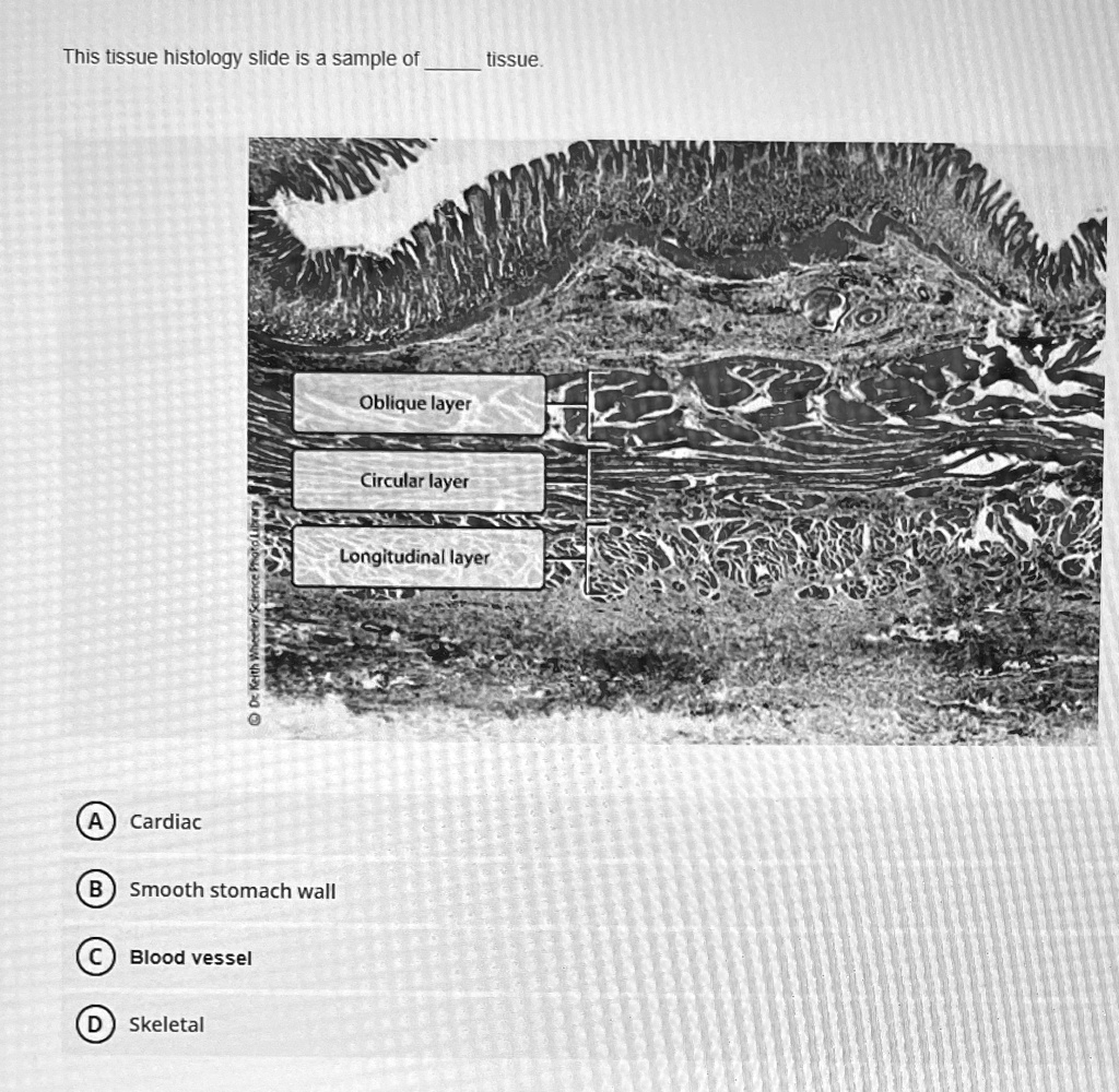 SOLVED: 'This tissue histology slide iS a sample of tissue Oblique layer Circular layer ...