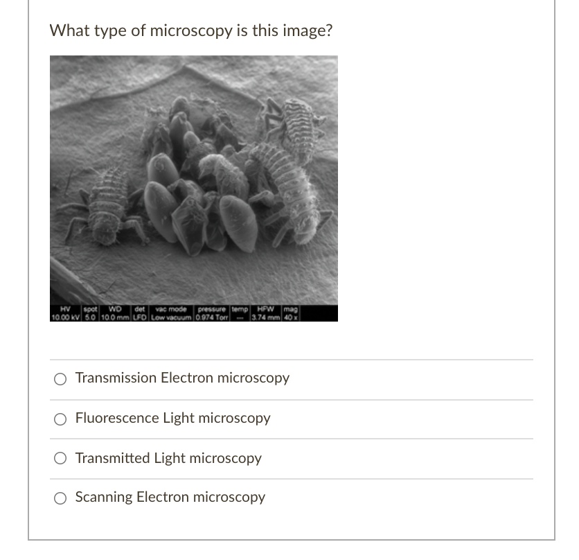 SOLVED: What type of microscopy is this image? MD Transmission Electron ...
