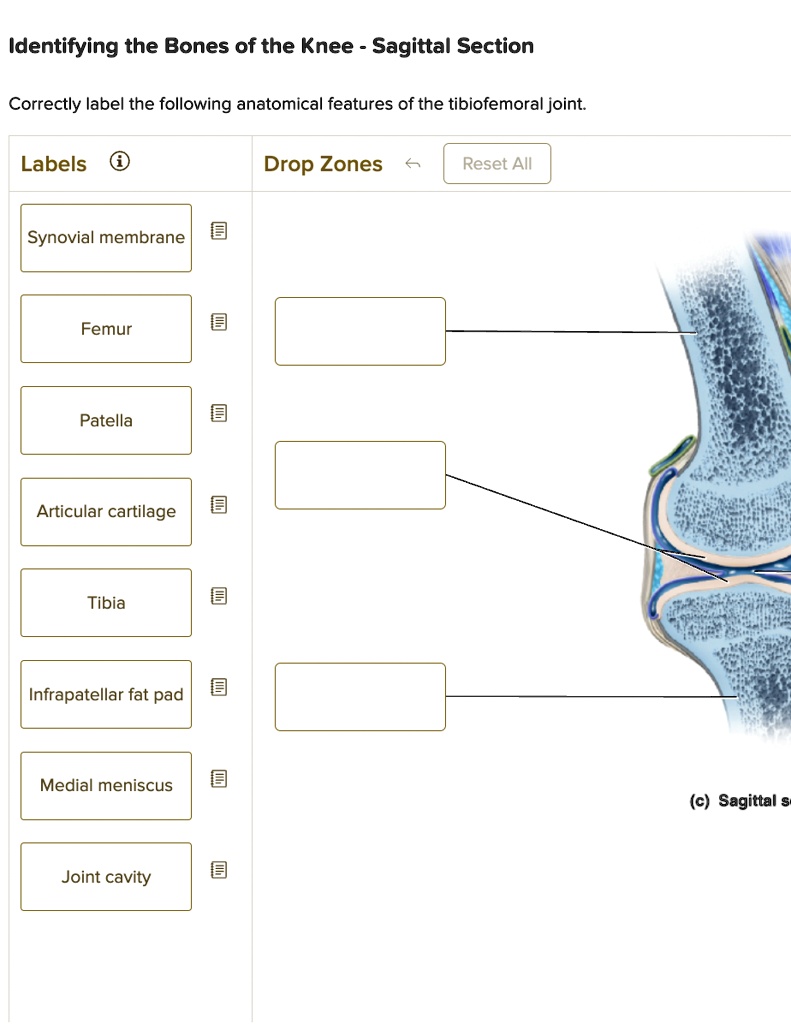 SOLVED: Identifying the Bones of the Knee - Sagittal Section Correctly label the following ...