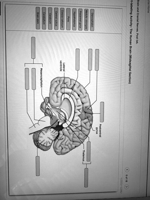 Brain and Cranial Nerves. Post-lab. Art-labeling Activity: The Human Brain (Midsagittal Section ...