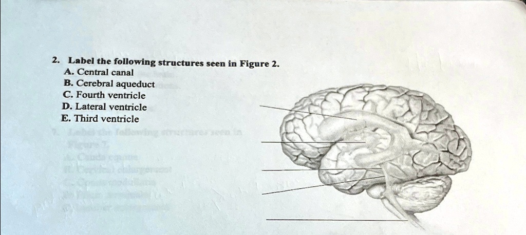 2. Label the following structures seen in Figure 2. A. Central canal B ...
