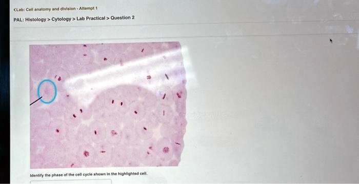 Cytology > Lab Practical > Question 2 Identify the phase of the cell ...