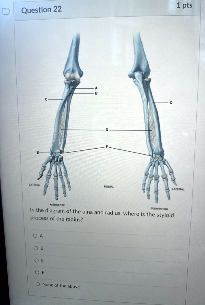 question 22 1 pts lateral anterior view a b d medial posterior view c ...