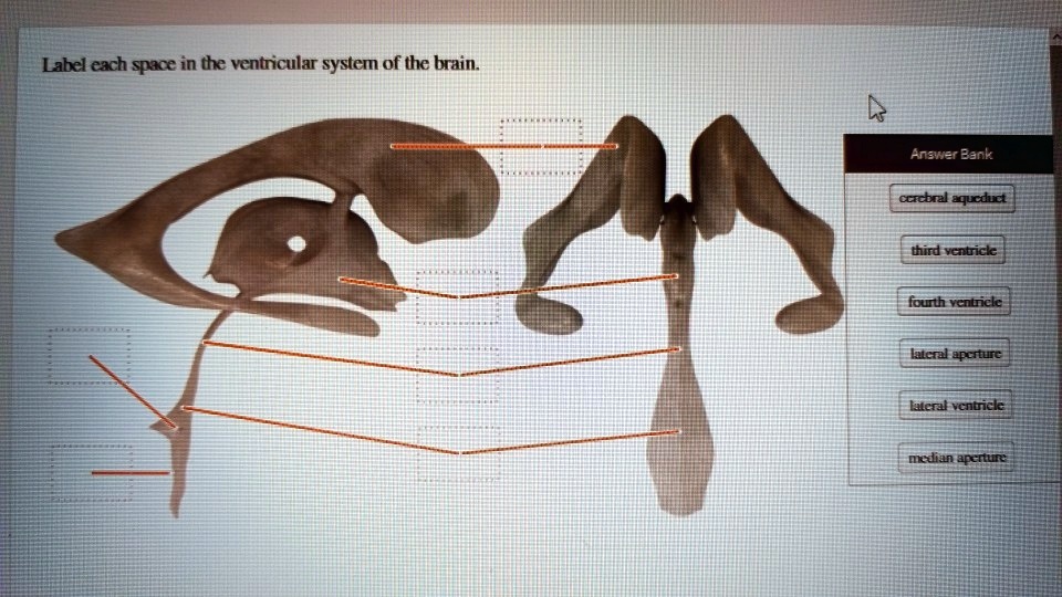 Label each space in the ventricular system of the...