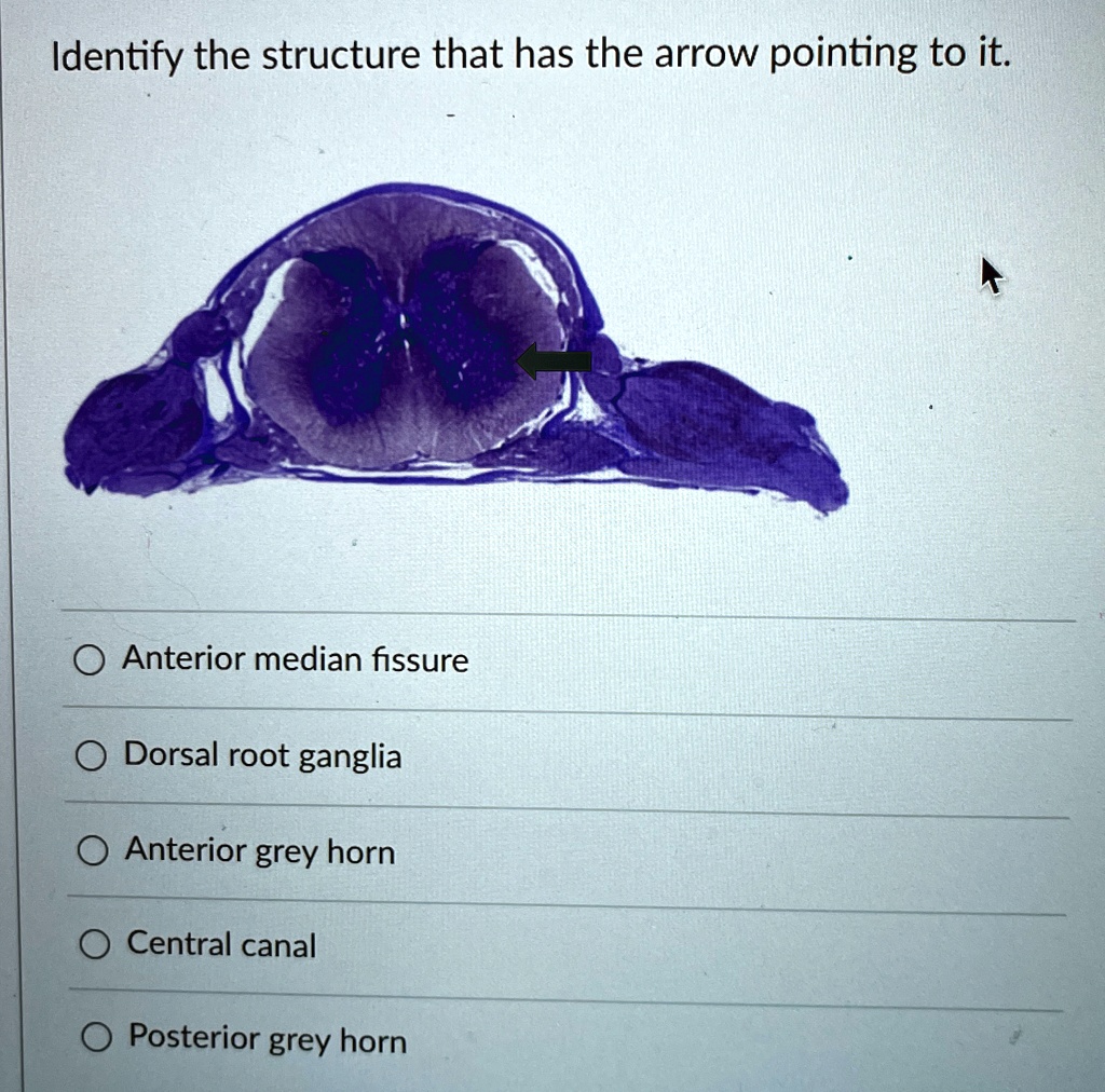 identify the structure that has the arrow pointing to it anterior median fissure dorsal root ...