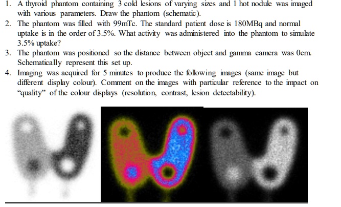 1. A thyroid phantom containing 3 cold lesions of varying sizes and 1 ...