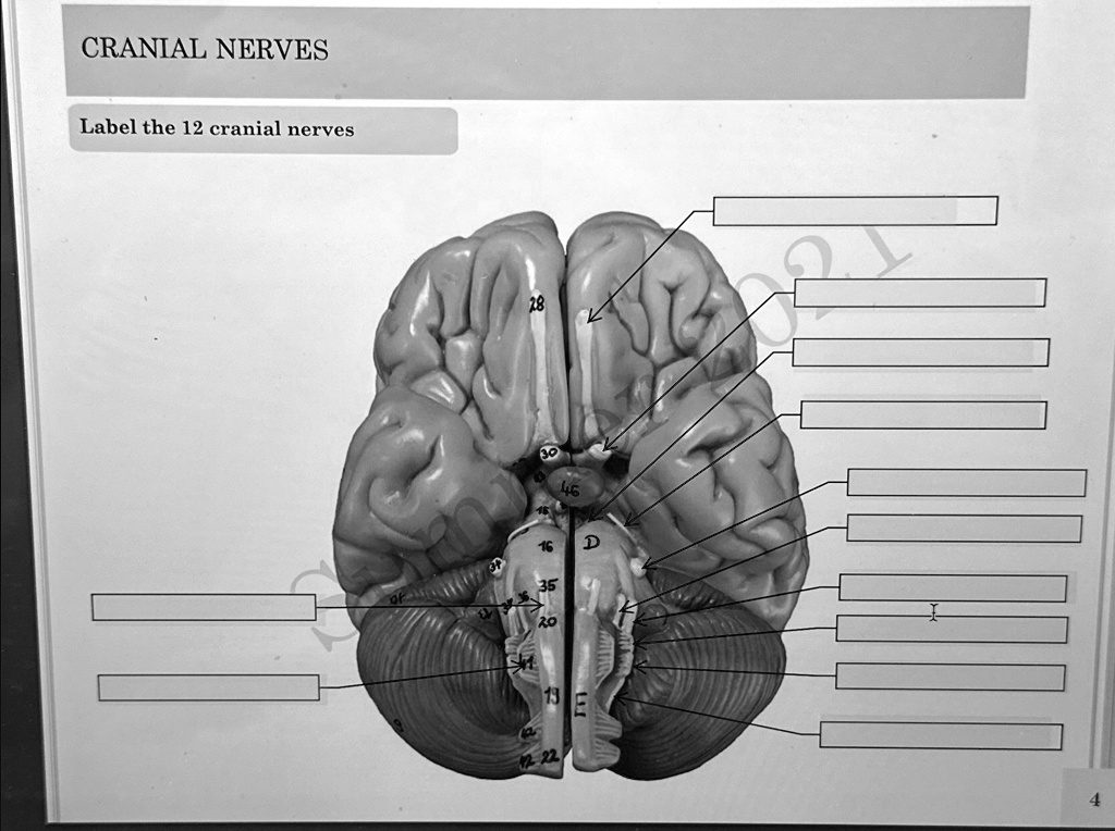 CRANIAL NERVES Label the 12 cranial nerves CRANIAL NERVES Label the 12 ...