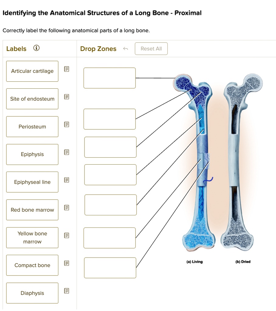 Identifying the Anatomical Structures of a Long Bone - Proximal Correctly label the following ...
