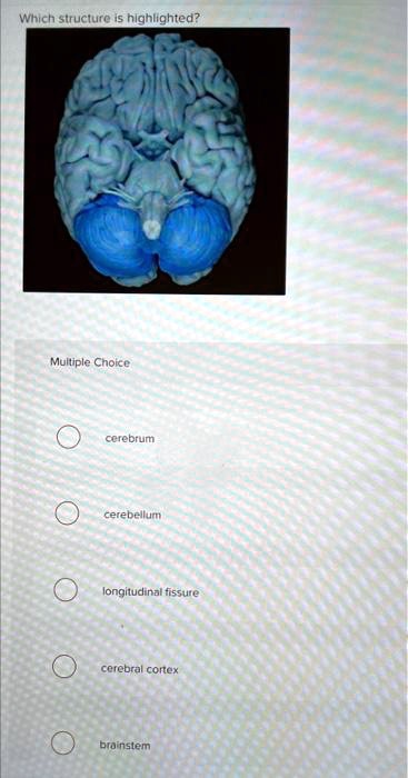 SOLVED: Which structure is highlighted? Multiple Choice cerebrum ...