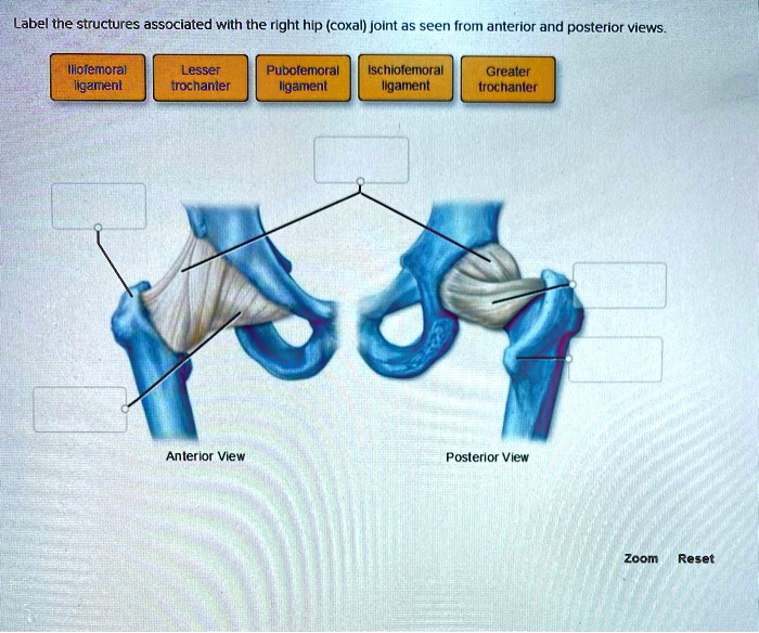 SOLVED: Text: Label the structures associated with the right hip (coxal) joint as seen from ...