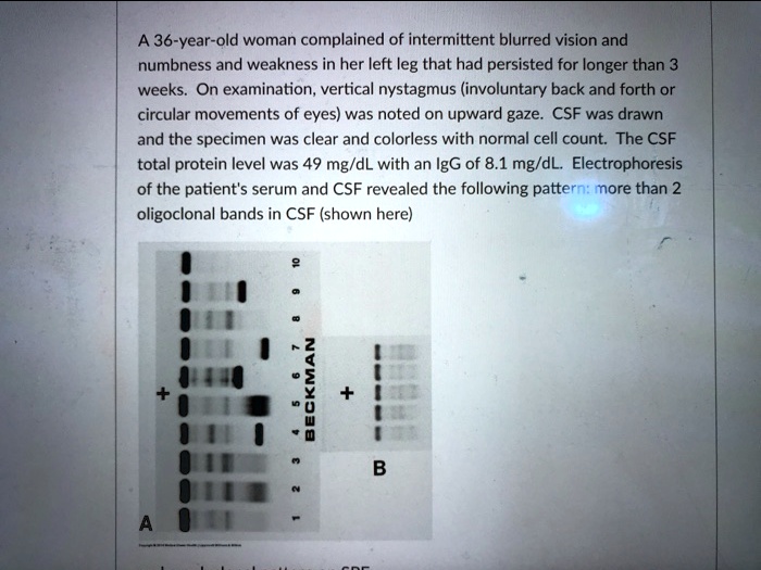 36 year old woman complained of intermittent blurred vision and ...