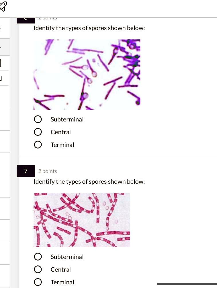 SOLVED: ZpOMTTS Identify the types of spores shown below: U 71 ...