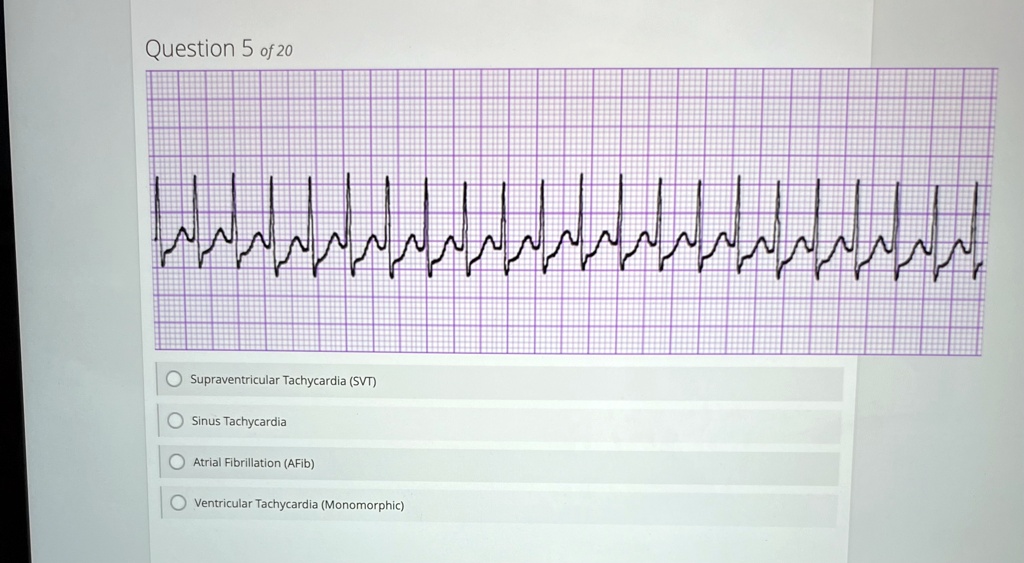 Question 5 of 20 Supraventricular Tachycardia (SVT) Sinus Tachycardia ...